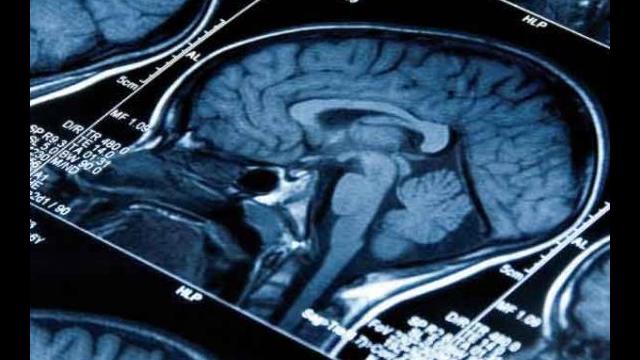 Mapping Baby's Brains Using MRI Scan | Action Medical Research